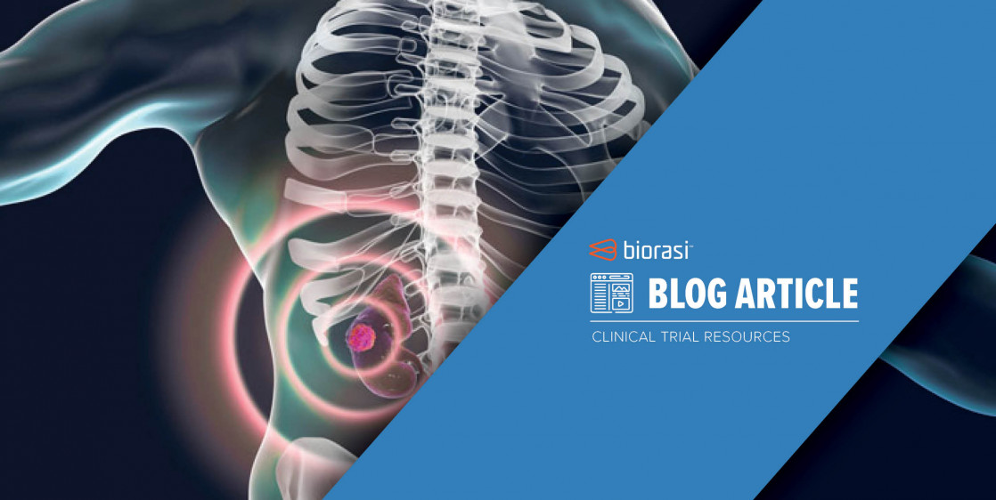 FSGS: A rare kidney disease without targeted therapies - Biorasi